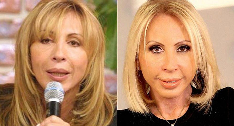 El antes y después de Laura Bozzo tras sus operaciones | MUJER | OJO