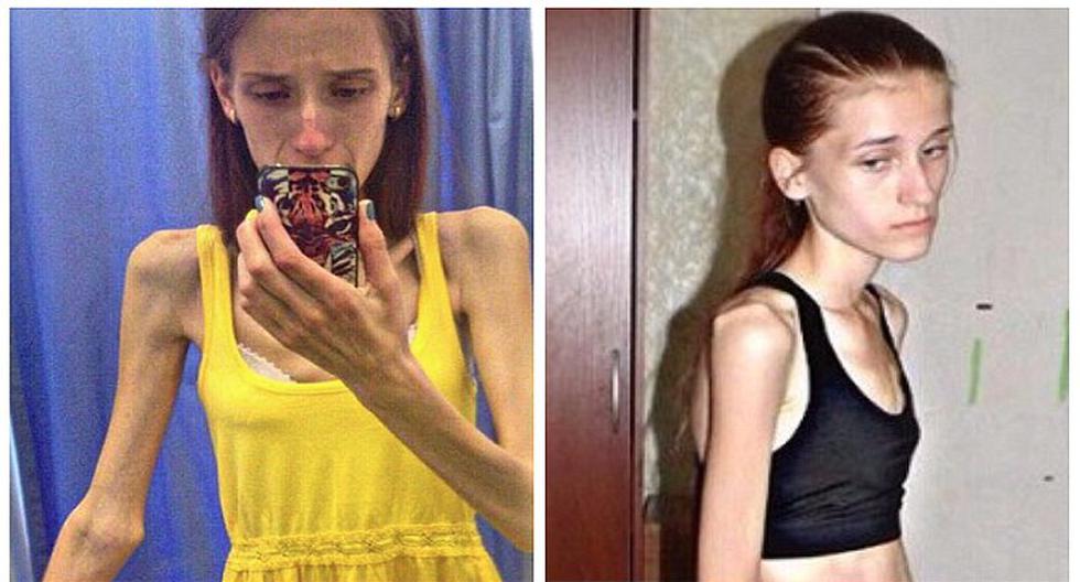 Mujer que pesaba solo 30 kilos, luce cuerpazo al recuperarse (FOTOS ...