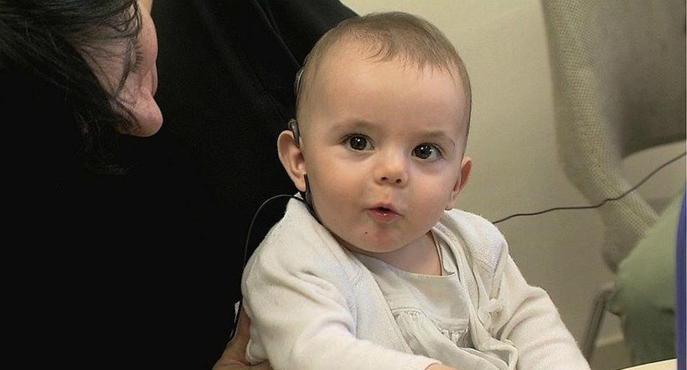 Bebé con sordera escucha por primera vez a su madre | MUJER | OJO