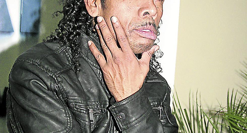 Cachay fue dado de alta en hospital | OJO-SHOW | OJO